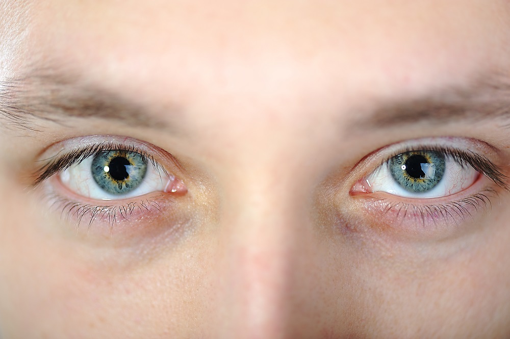 Macular Degeneration What You Need To Know Ottawa Optometrist Eye 
